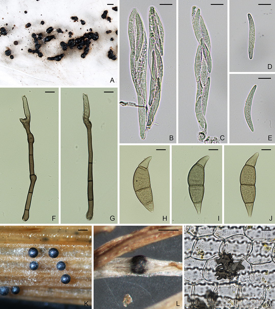 Nakataea oryzae - An E-monograph of the Fungal Order Magnaporthales ...